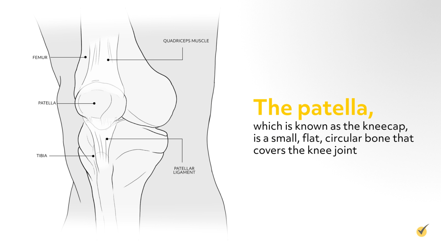Managing Different Types of Patellar Fractures (Video)